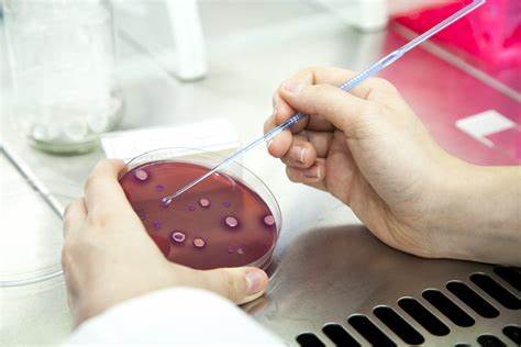 Résumé de TP MICROBIOLOGIE